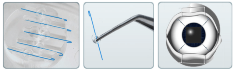 IRIS RETRACTORS | Global | Biotech Healthcare